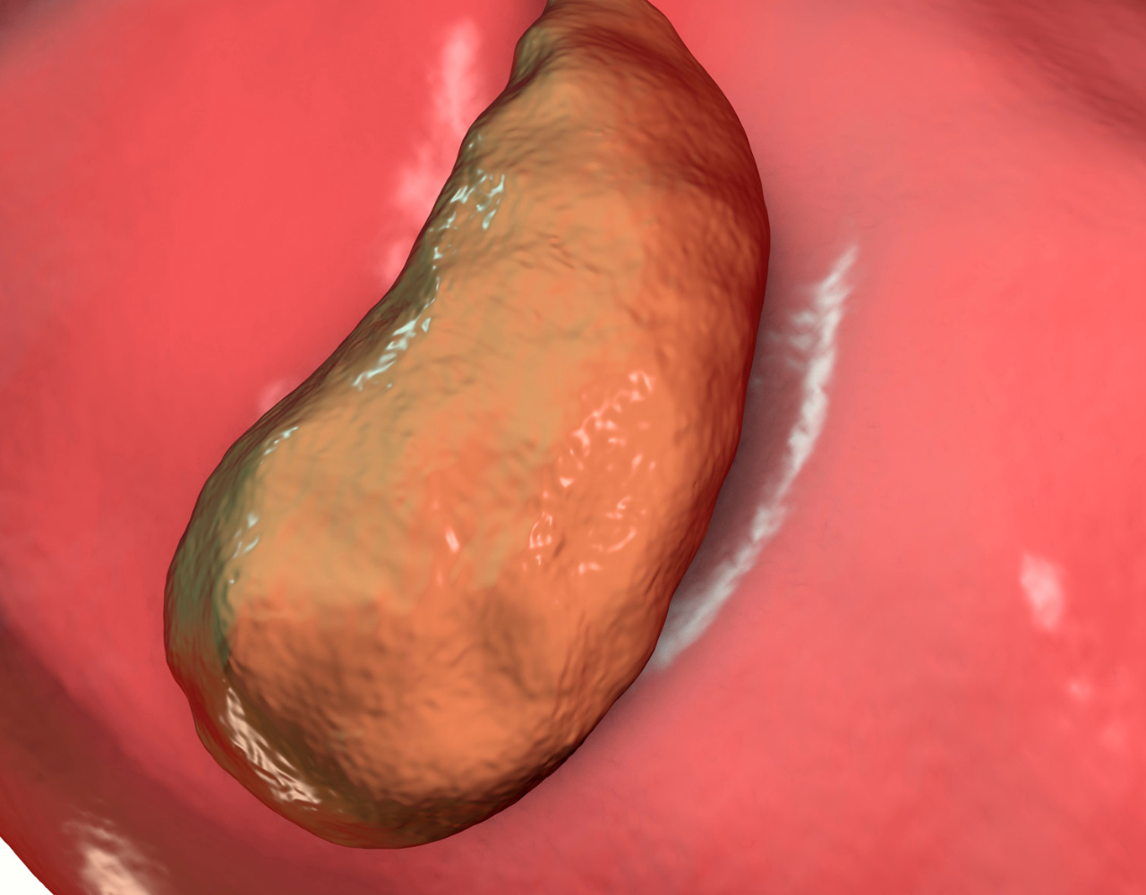 📌 Vesícula Biliar e Ducto Colédoco | VetNet